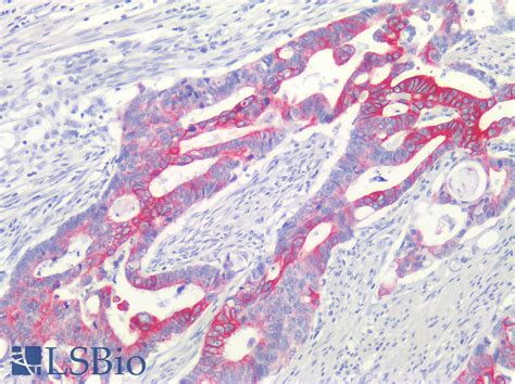 PathPlus KRT20 CK20 Cytokeratin 20 Monoclonal Antibody IHC LSBio