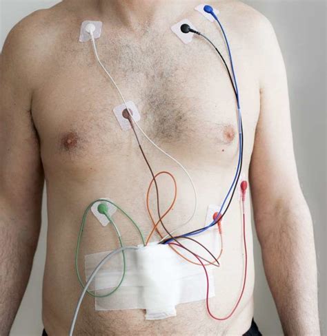 24 Hour Holter Monitoring Uses Results And What To Expect