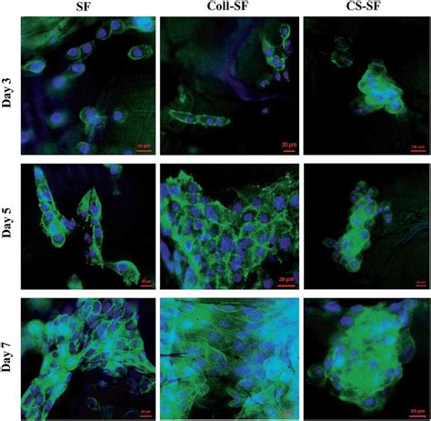 Actin Cytoskeleton Staining Of Mg63 Cells With Alexafluor Phalloidin