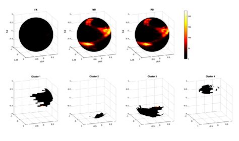 Directional Analysis Of The Significant Microstructural Differences In Download Scientific