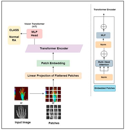 Ra Xtnet A Novel Cnn Model To Predict Rheumatoid Arthritis From Hand