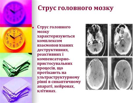 Травми голови та головного мозку презентация онлайн