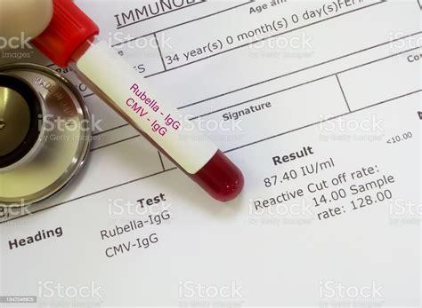 Technician Hand Hold Blood Sample With Abnormal Rubella Igg And Cmv Igg