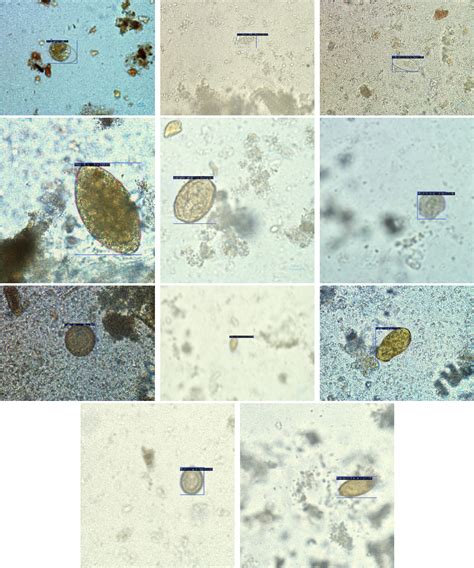Figure 1 From Parasitic Egg Detection With A Deep Learning Ensemble