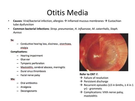 Vertigo In The Emergency Department Pptx