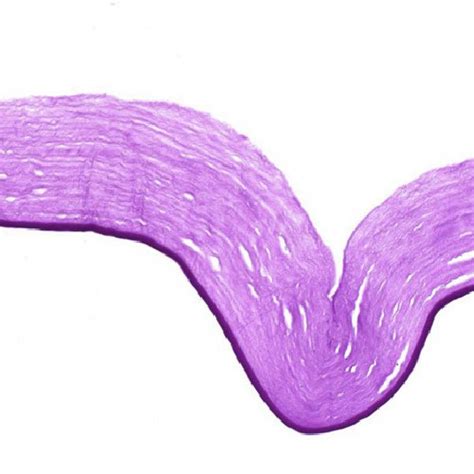 B Corresponding Histopathological Appearance Of His Dsaek Graft Download Scientific Diagram