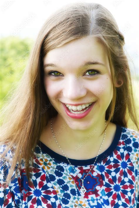 Lachendes Mädchen mit Zahnspange Stock Foto Adobe Stock