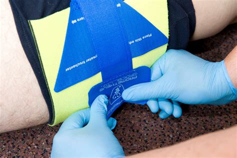 The Prometheus Pelvic Splint Has Safeguard Public Safety