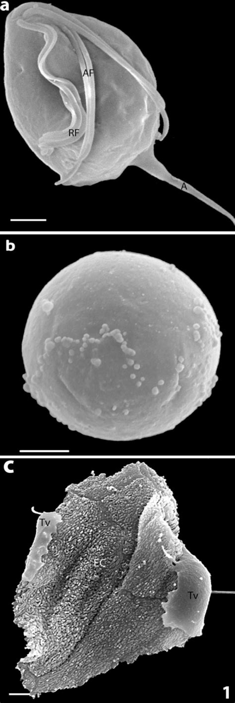 General View Of Trichomonas Vaginalis Tv In Three Different Forms Download Scientific