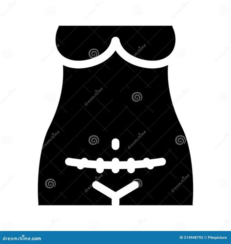 Cesarean Section Icon Vector Glyph Illustration Stock Vector