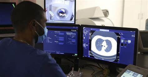 Millions Of Eligible Patients Skipping Life Saving Lung Cancer Screening Cbs Boston