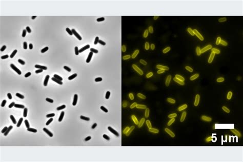 Fluorescence Microscopy Bacteria