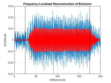 Wavelet Analysis Of Physiologic Signals Matlab And Simulink Example