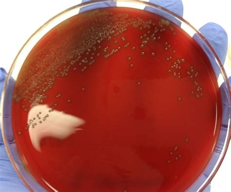 Streptococcus Pneumoniae Microbiology Streptococcus Pneumoniae Med Lab