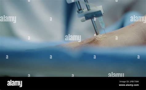 Prp Procedure Stock Videos And Footage Hd And 4k Video Clips Alamy