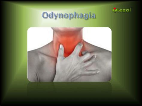 Ppt Odynophagia Causes Symptoms Daignosis Prevention