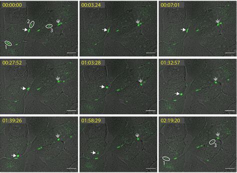 Live Cell Time Lapse Imaging Of Hela Cells Engineered To Express