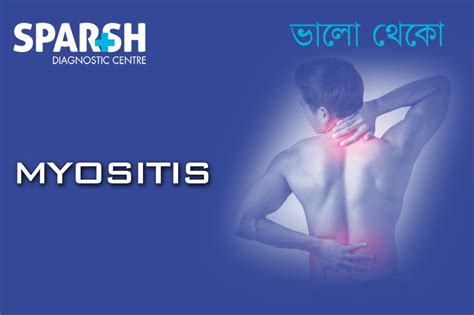 Myositis Understanding The Rare Autoimmune Disease Sparsh Diagnostic Center