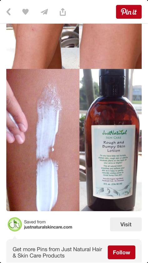 Pin On Skin Care Beauty Hacks Bumpy Skin Lotion Skin Lotion