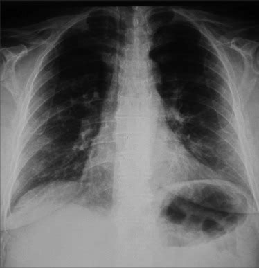 Initial Chest X Ray Within Normal Parameters Download Scientific Diagram