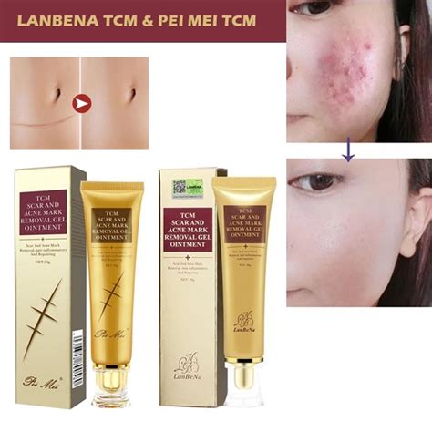 Jual CS TCM SCAR And ACNE REMOVAL Gel Ointment Penghilang Bekas Luka
