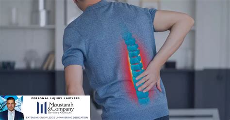 Edmonton Spinal Cord Injury Lawyer Moustarah And Company