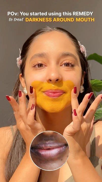 Pov You Started Using This Remedy To Treat Darkness Around Mouth