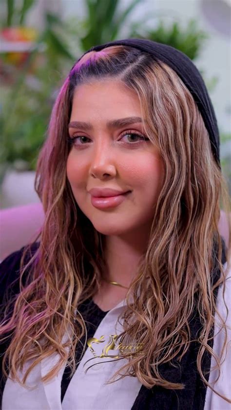 ‎دکتر نجمه زندی پورمتخصص جراحی فک،صورت و زیباییدارای بورد تخصصی‎ ‎یه قبل ک بعد جذابمون نشه