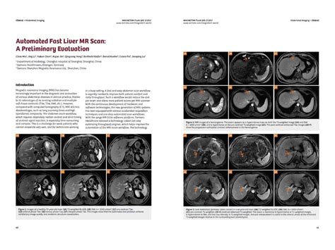A Time Optimized Workflow For Primovist® Liver Mri