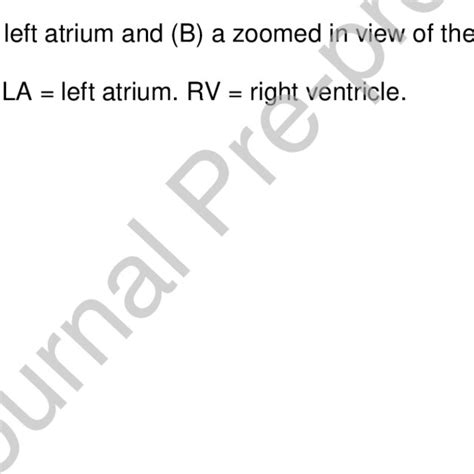 M Mode Echocardiography Of Ivc Demonstrating Plethora And Lack Of
