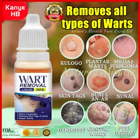 Warts Remover Original 10ml Genital Warts Anal Warts Skin Tags Plantar