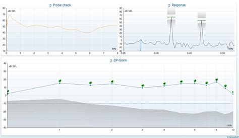 Otoacoustic Emissions Oaes For Ototoxicity Monitoring