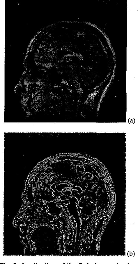 Figure 2 From A New Method For Image Segmentation Based On Fuzzy Knowledge Semantic Scholar