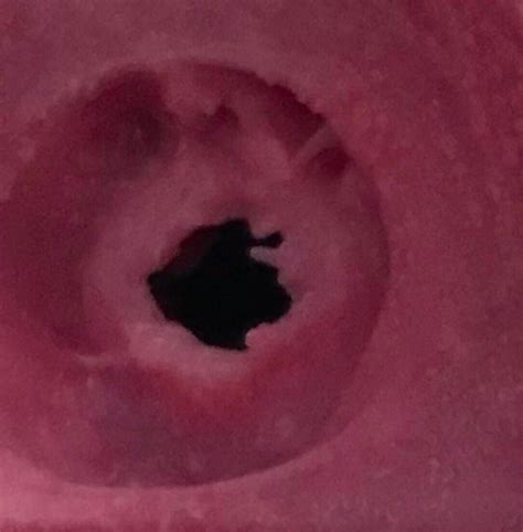 Как выглядят остатки девственной плевы фото