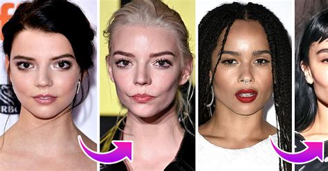 14 Celebrities Who Achieved Chiseled Cheekbones And Drastically Altered