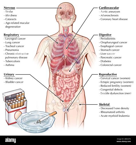 Organs Damaged From Smoking