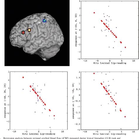 Figure 3 From A Functional Anatomical Model For Lipreading Semantic Scholar