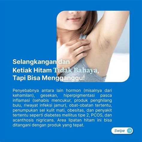 Solusi Mudah Mencerahkan Lipatan Ketiak And Selangkangan Hitam Diri Care