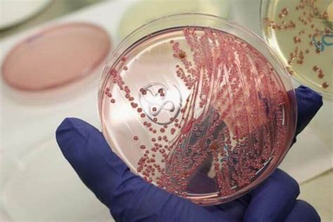 Escherichia Coli Prijenos Simptomi I Liječenje