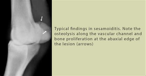 Sesamoiditis In Horses Inflammation Of The Sesamoid Bones