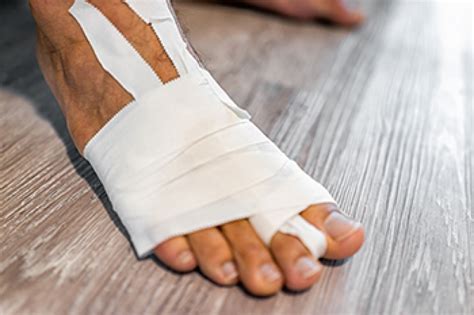 Causes And Symptoms Of Turf Toe