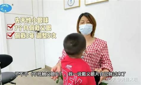 武汉美目义眼与先天性小眼球宝宝共同成长 知乎