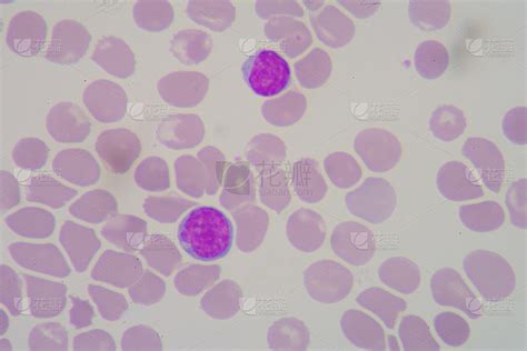 红细胞 显微镜 水平画幅 科学 生物学 实验室 特写 活力 嗜碱细胞