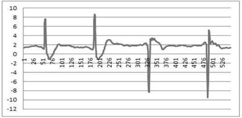 Accelerometer View A Definition Of Vehicle Direction B And C