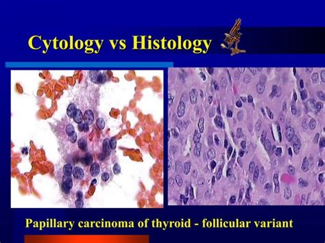 3755892ppt Fine Needle Aspiration Cytol Ppt