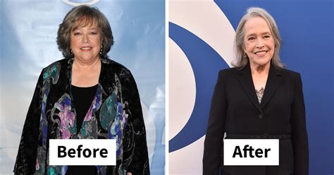 Im Ashamed” Kathy Bates Reveals 100 Lb Weight Loss And Explains How