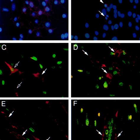 Cd34 Expression During Skeletal Muscle Development A And B Whole