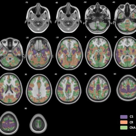 Whole Brain Resting State Functional Connectivity Map For Bilateral