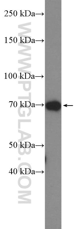 Dusp16 Antibody 14237 1 Ap Proteintech