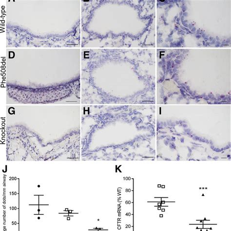 Cystic Fibrosis Transmembrane Conductance Regulator Cftr Mrna